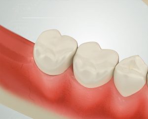 DIO Navi - DIOimplant.LV